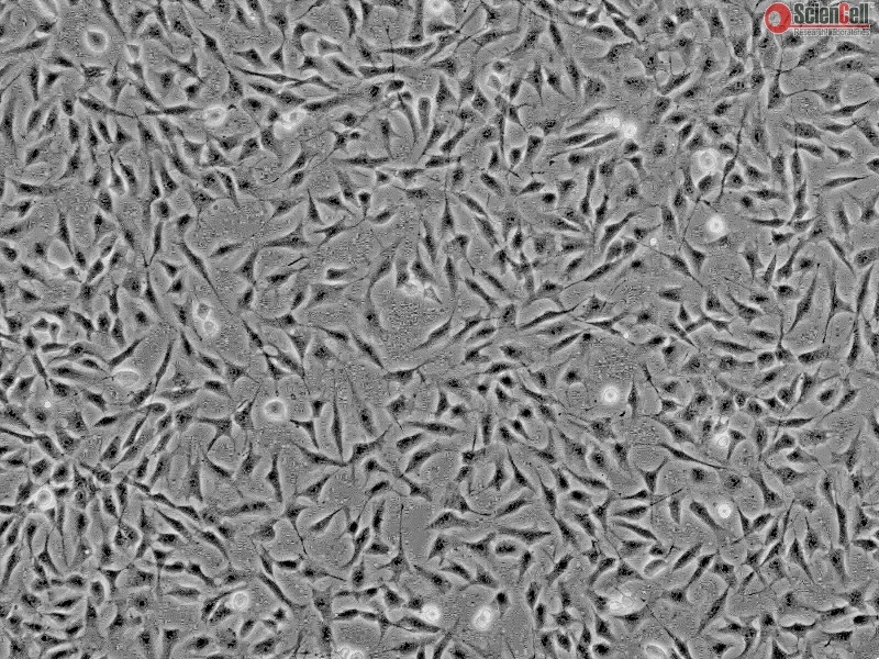 Human Keratocytes, HK
