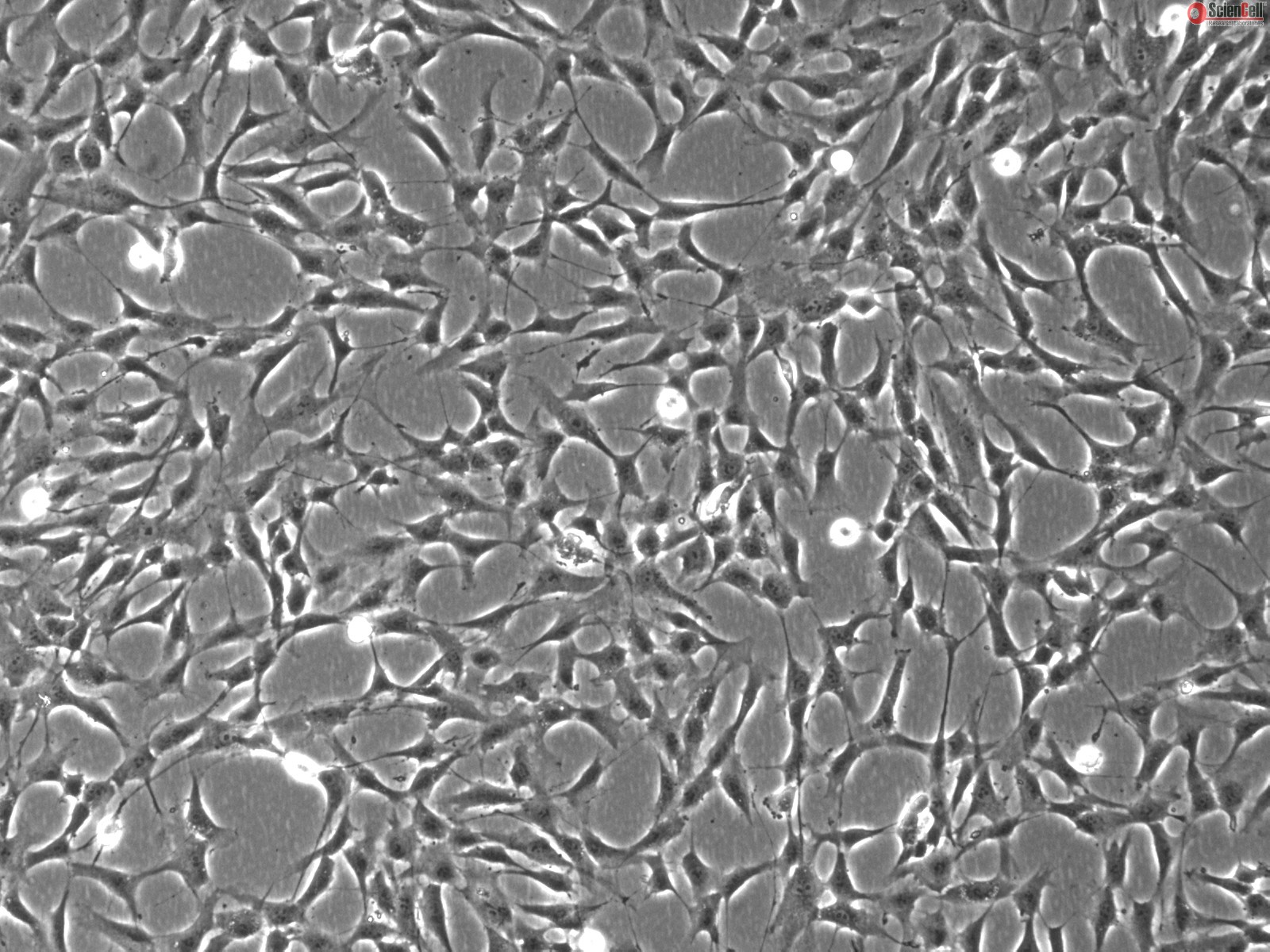 Human Primary Dural Fibroblasts, Passage 1