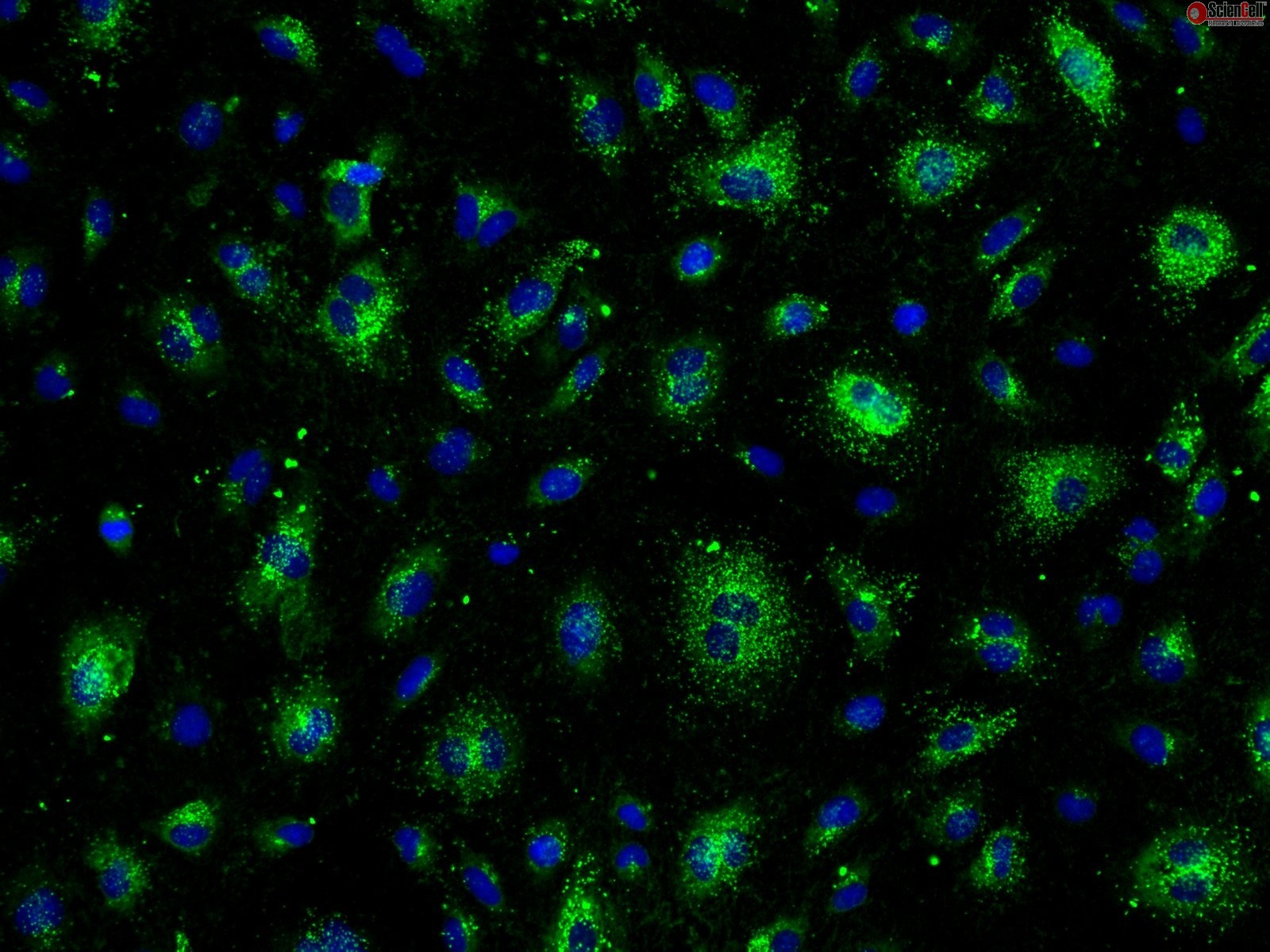 Human Dural Microvascular Endothelial Cells, Passage 1