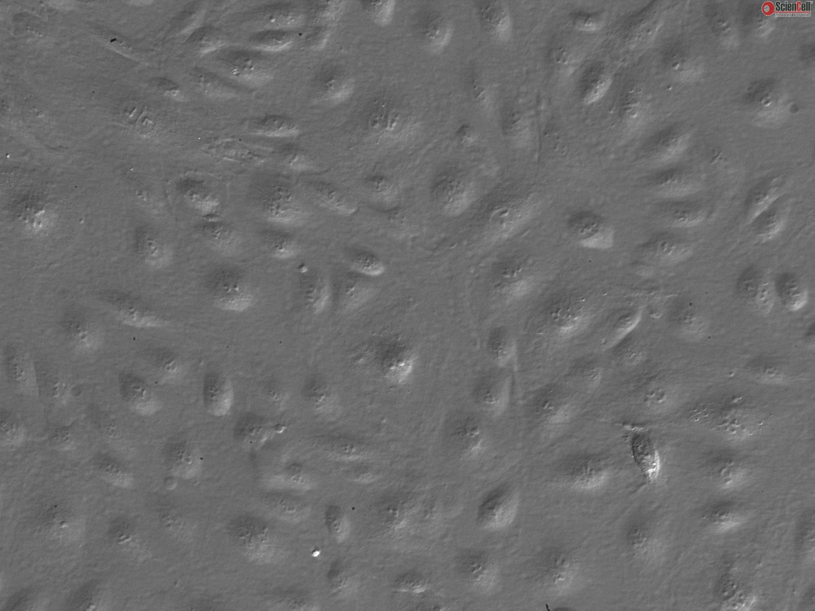 Human Dural Microvascular Endothelial Cells, Passage 1