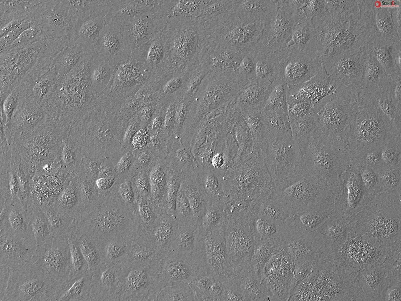 Human Tonsil Endothelial Cells (HTEC)