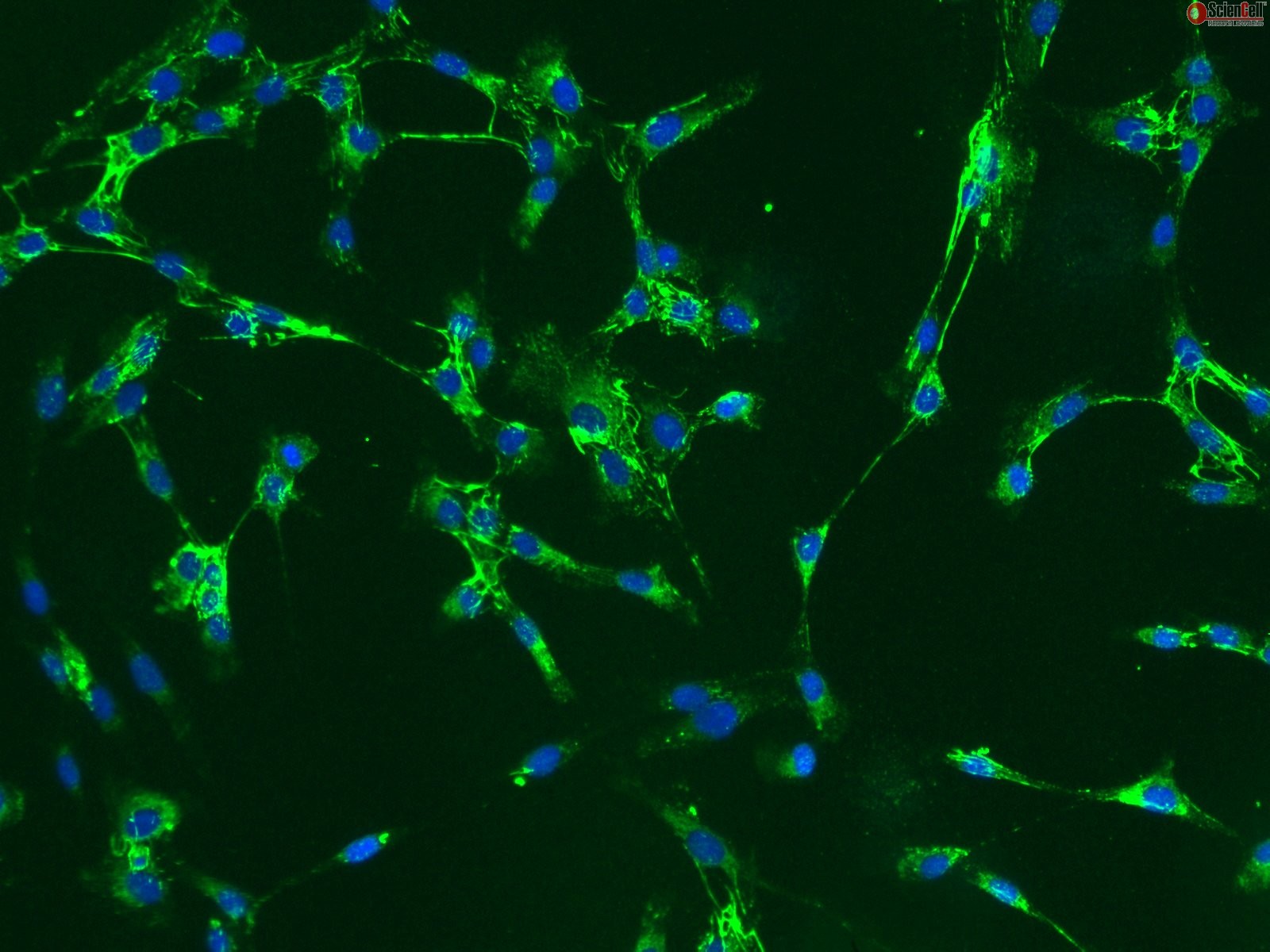 Human Oral Fibroblasts (HOrF)