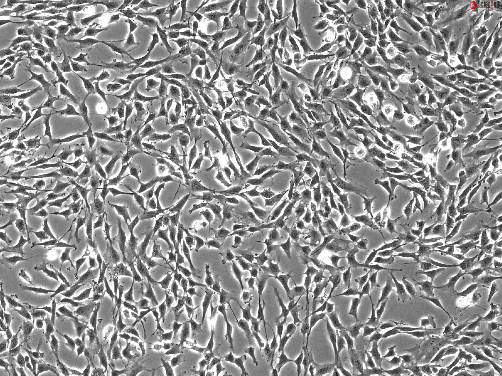 Human Oral Fibroblasts (HOrF)
