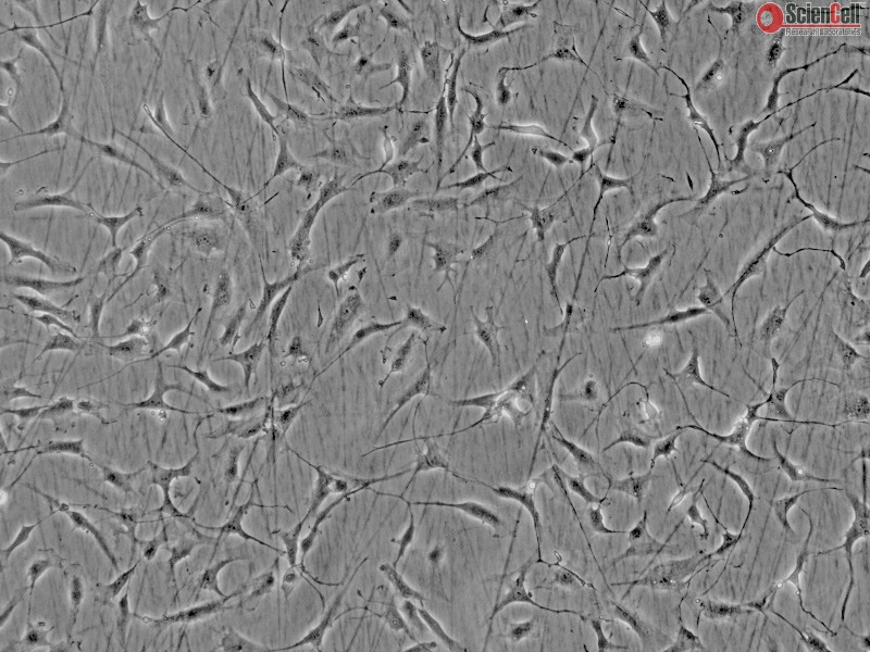 Human Cardiac Fibroblasts-adult (HCF-a