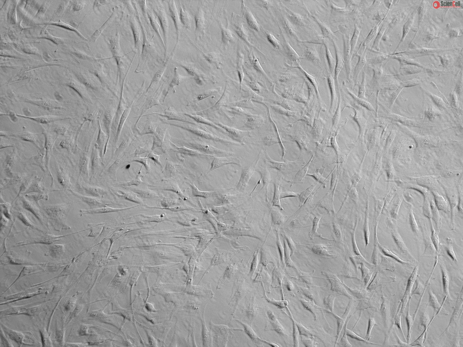 Human Cardiac Fibroblasts-adult (HCF-a