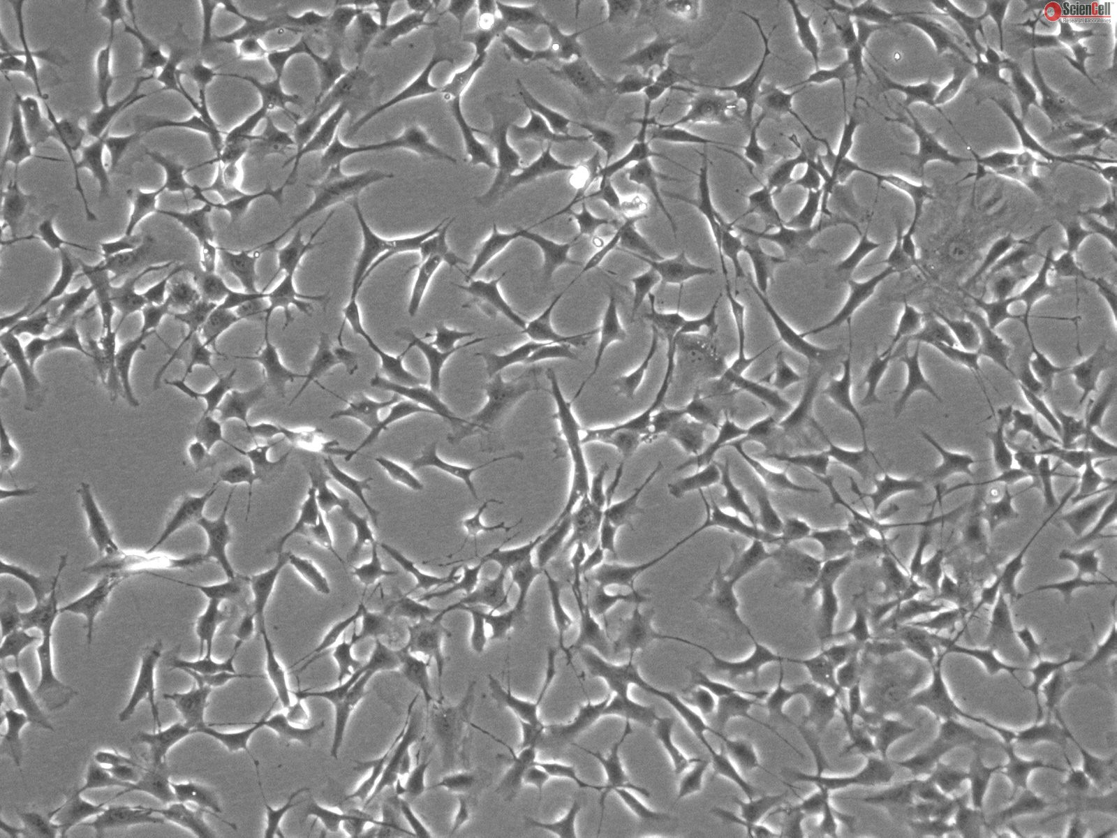Human Iris Fibroblasts