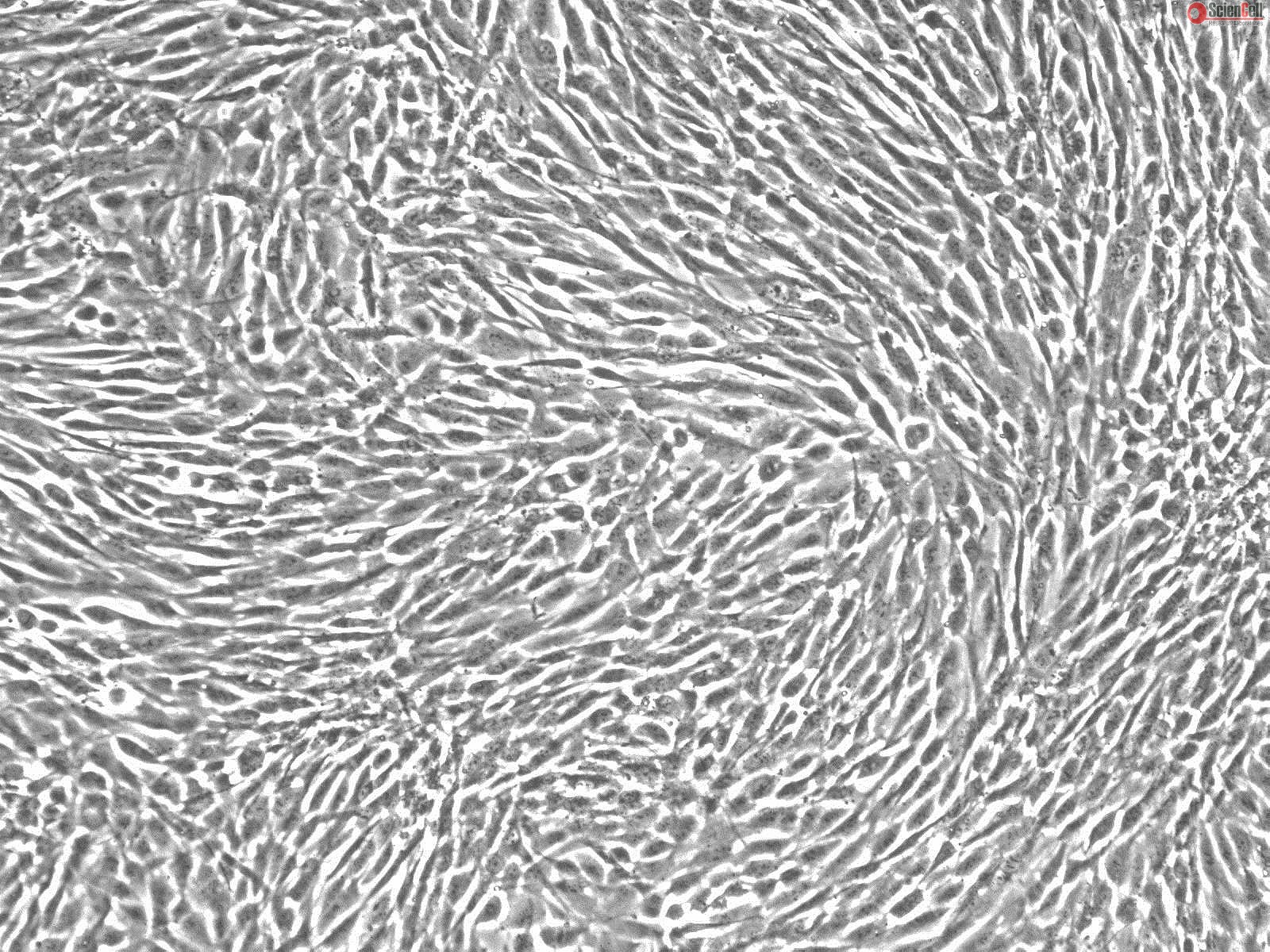 Human Preadipocytes-visceral, HPA-v