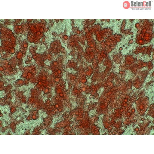Human Preadipocytes-visceral, HPA-v