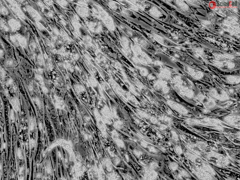 Human Preadipocytes-subcutaneous, HPA-s