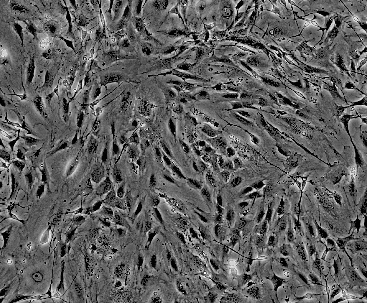 Mouse Perineural Fibroblasts