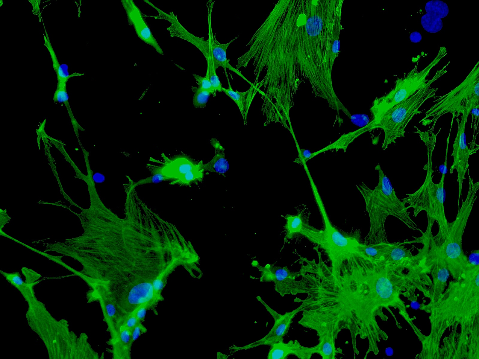 Mouse Hepatic Stellate Cells from CD1