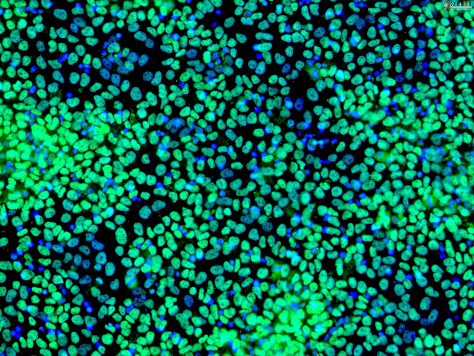 iPSC-derived Human Neural Stem Cells (iPSC-HNSC) iPSC-derived Human Neural Stem Cells (iPSC-HNSC)