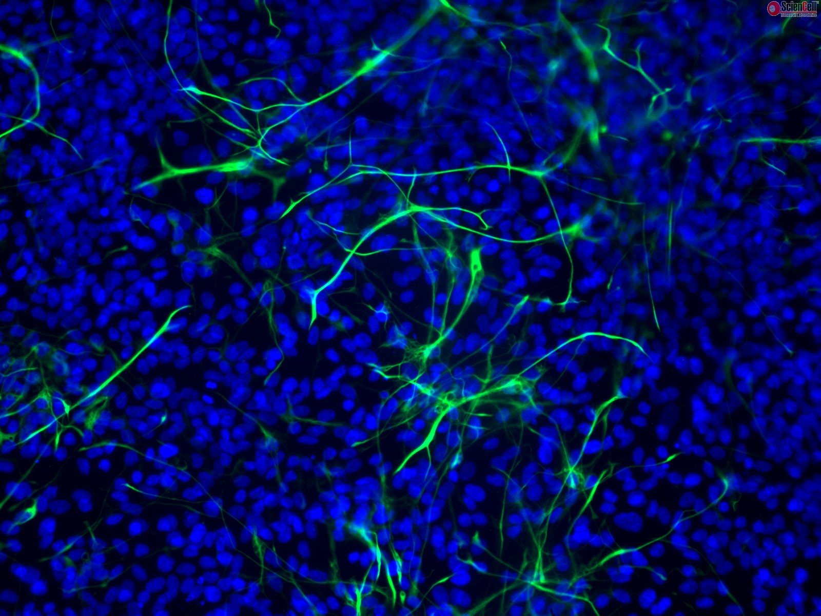 iPSC-derived Human Neural Stem Cells (iPSC-HNSC) iPSC-derived Human Neural Stem Cells (iPSC-HNSC)