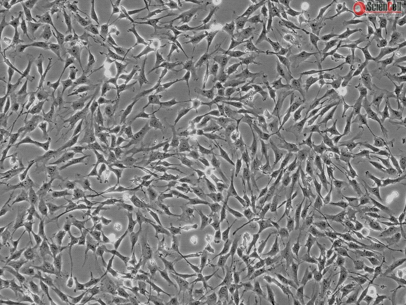 Human Perineurial Cells, Passage 1, HPC