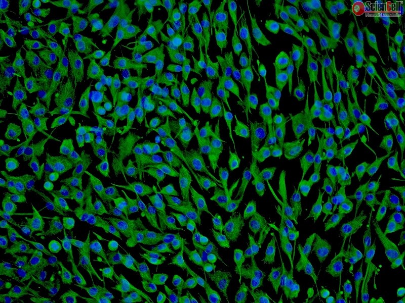Human Perineurial Cells, Passage 1, HPC