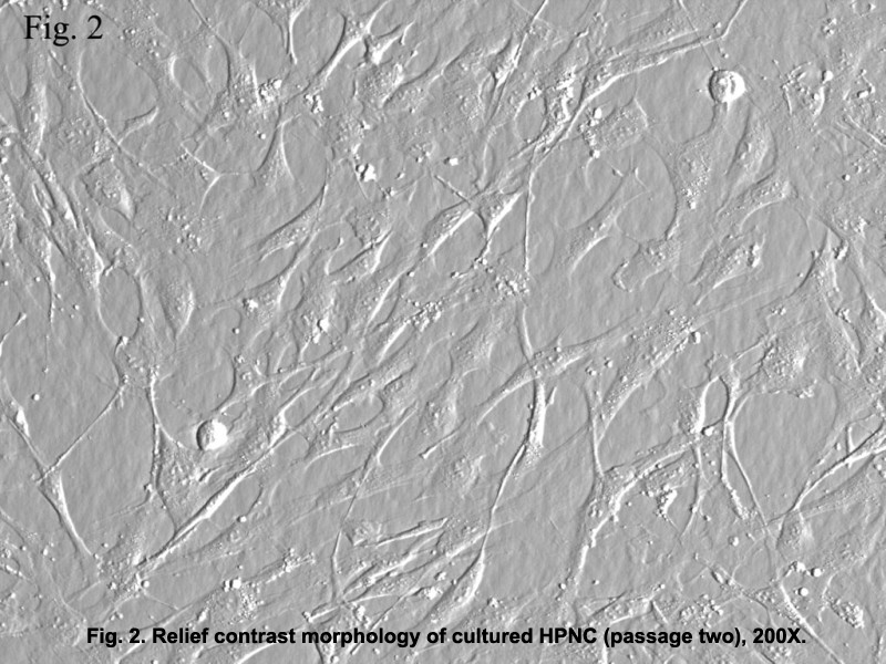 Human Perineurial Cells, Passage 1, HPC