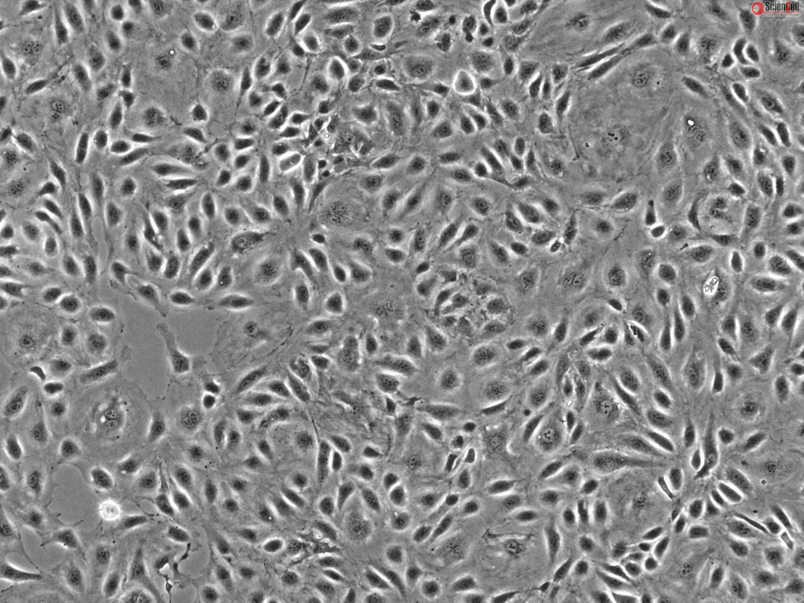 Human Dermal Lymphatic Endothelial Cells, HDLEC