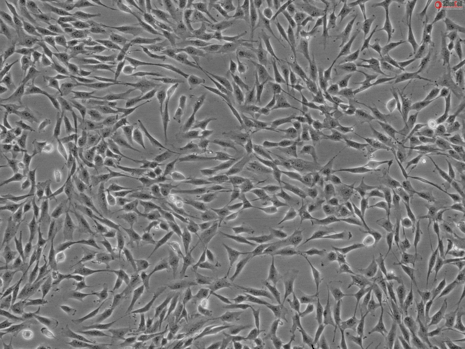 Human Dermal Fibroblasts - neonate, HDF-n