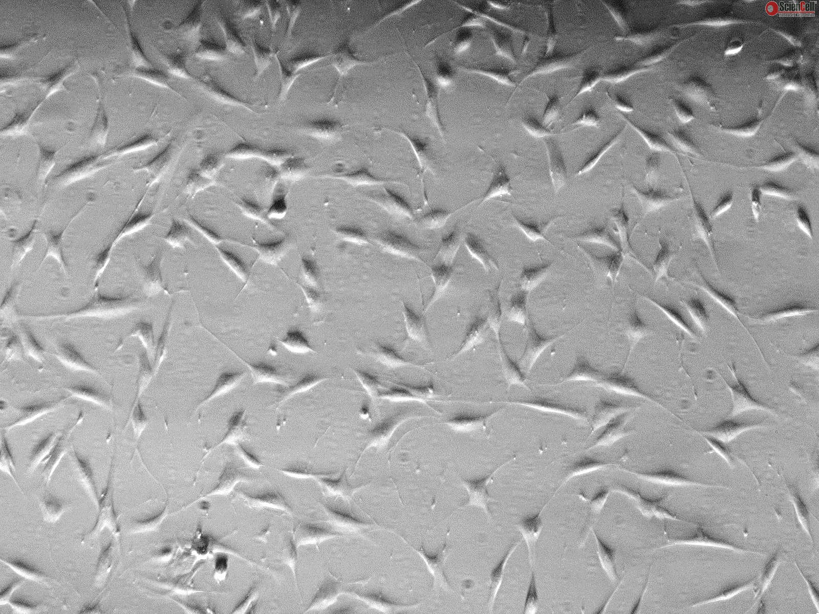 Human Dermal Fibroblasts - neonate, HDF-n