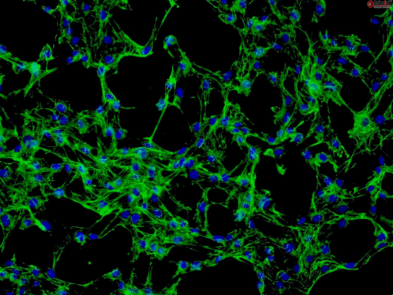 HLA-A*01 Positive Human Primary Dermal Fibroblasts-adult, Passage 1