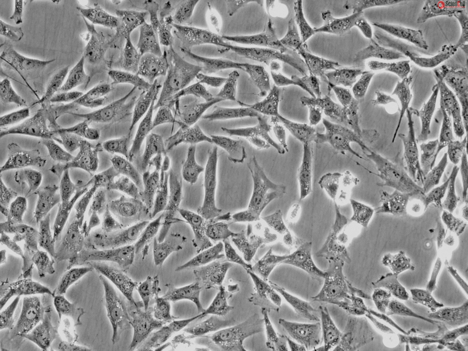 Human Hair Follicle Outer Root Sheath Cells, HHFORSC