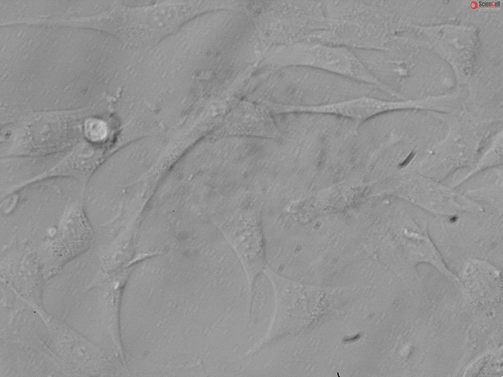 Human Hair Follicle Outer Root Sheath Cells, HHFORSC