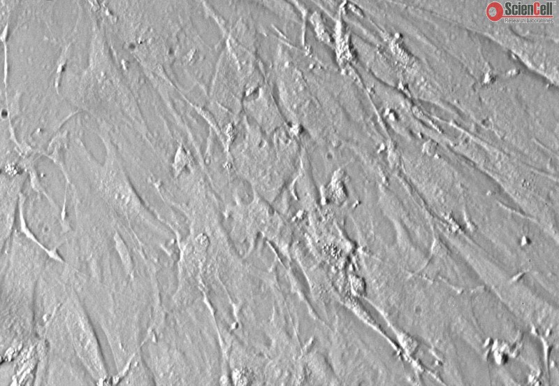 Human Hair Follicle Inner Root Sheath Cells, HHFIRSC