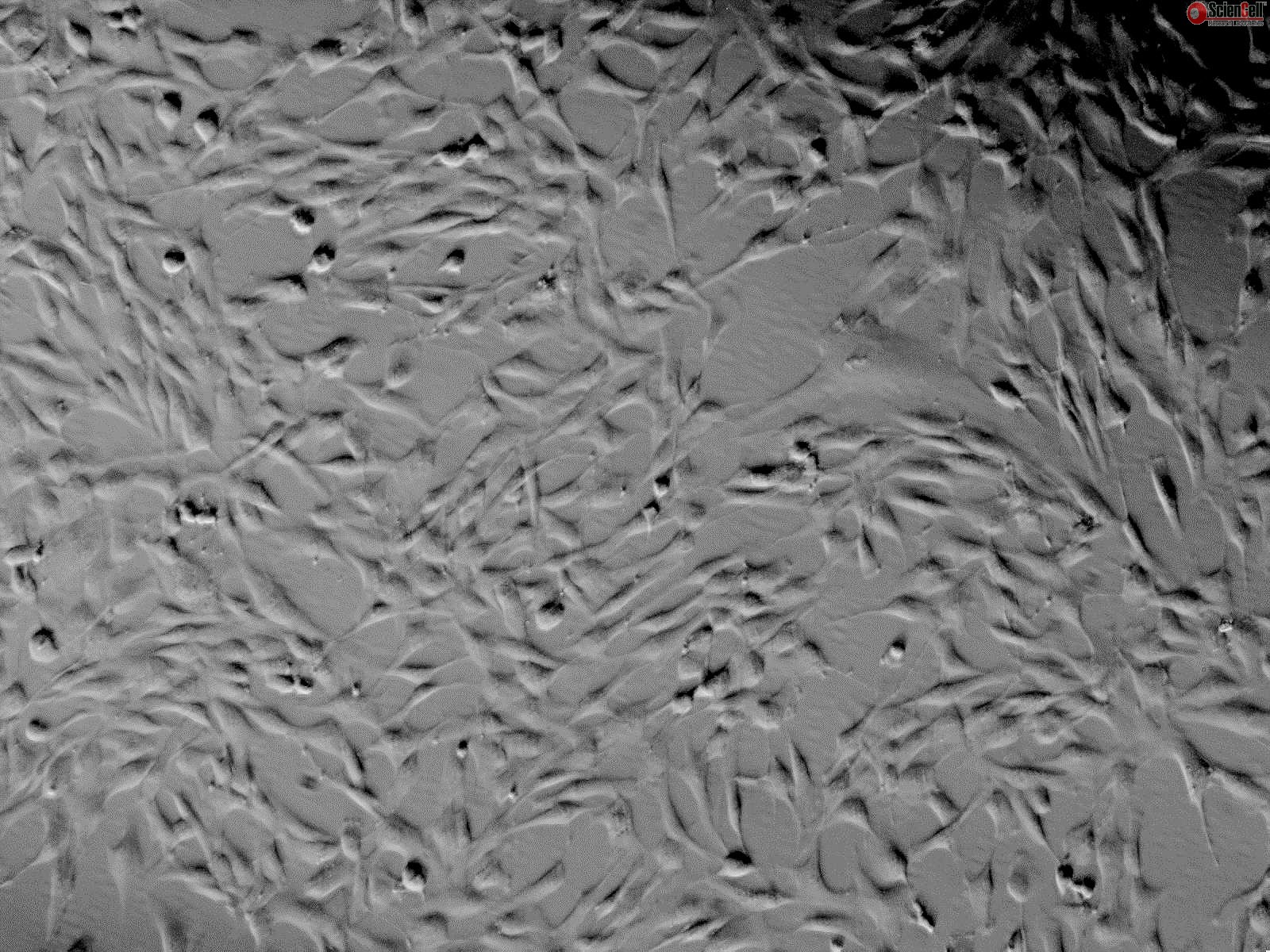 Human Tonsil Fibroblasts (HTF)