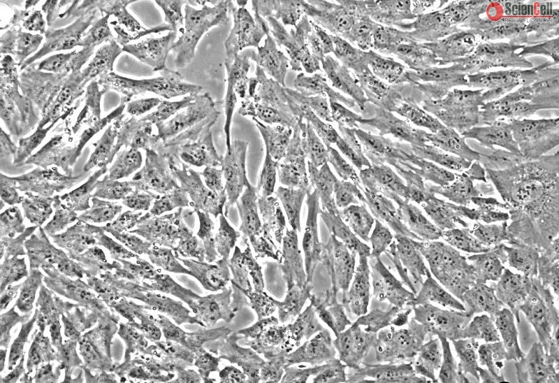 Human Primary Intestinal Smooth Muscle Cells, HISMC