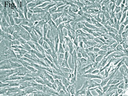 Human Primary Intestinal Smooth Muscle Cells, HISMC