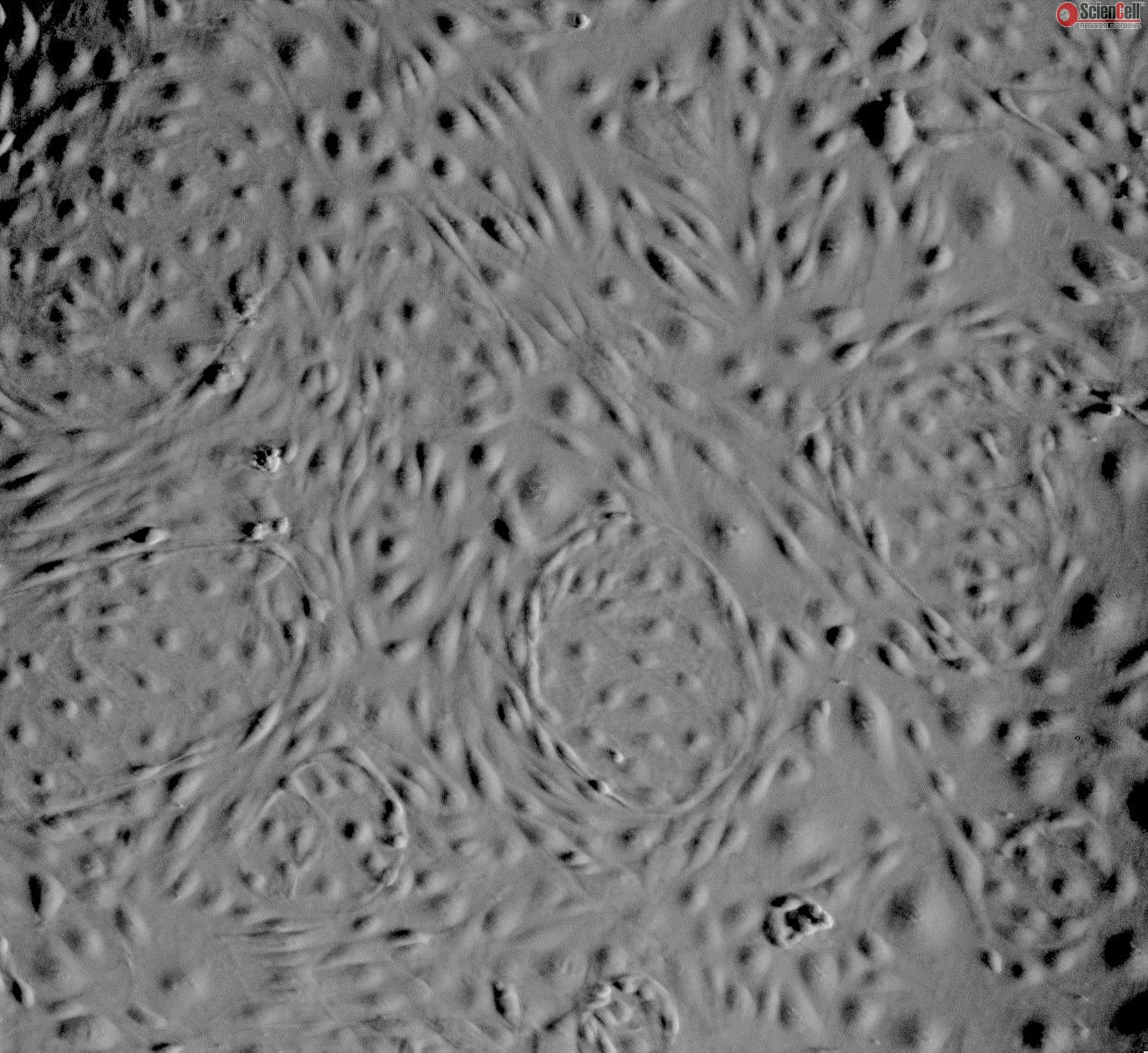 Human Pulmonary Microvascular Endothelial Cells, HPMEC