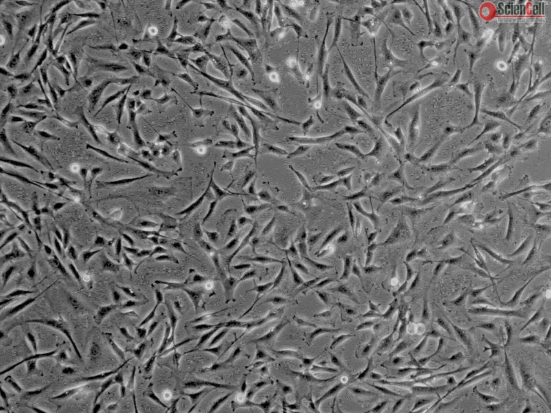 Human Pulmonary Artery Smooth Muscle Cells Human Pulmonary Artery Smooth Muscle Cells