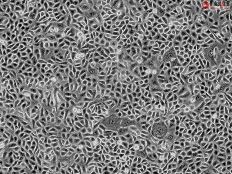 Human Bronchial Epithelial Cells