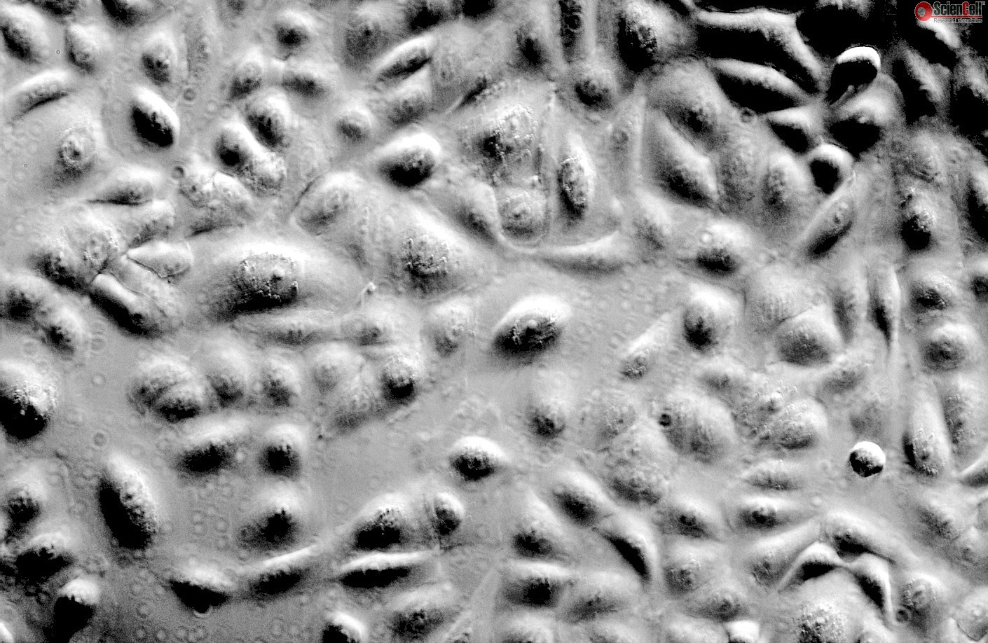 Human Tracheal Epithelial Cells