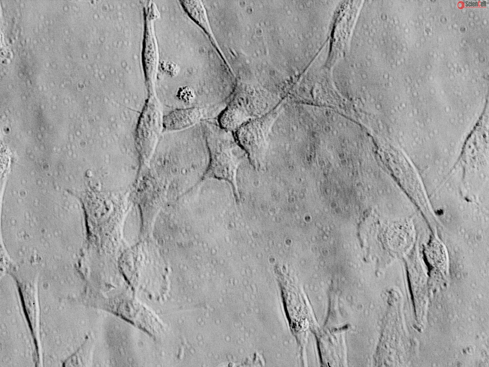 Human Pulmonary Fibroblasts-adult