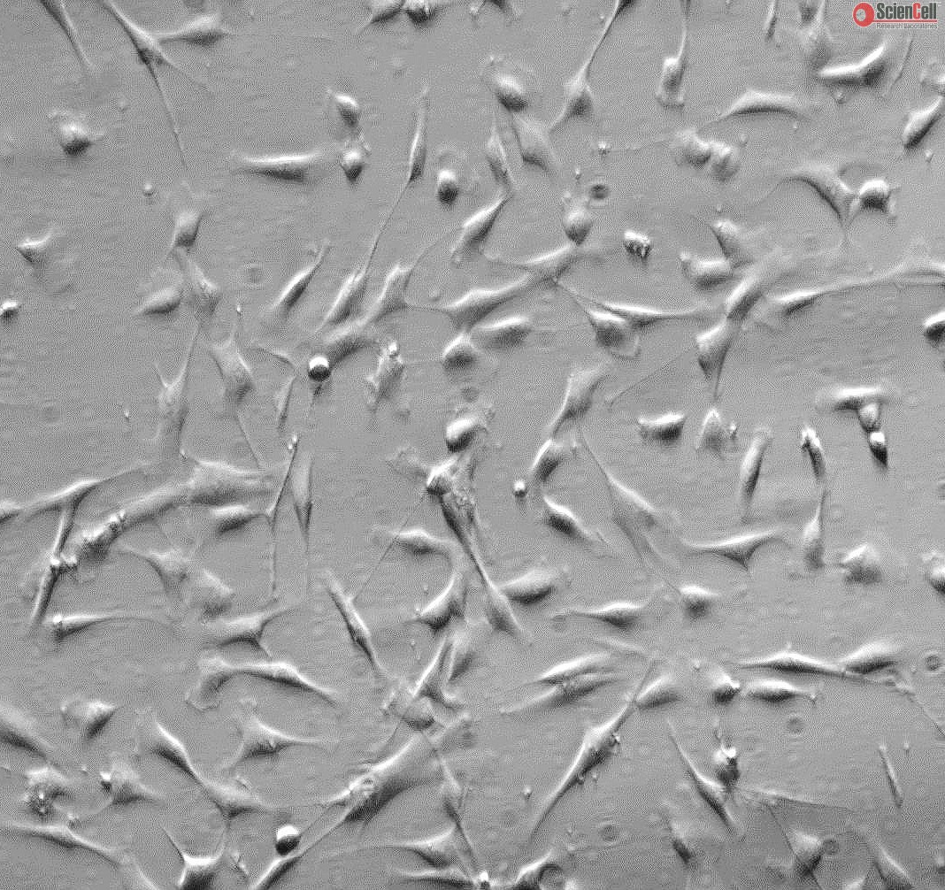 Human Tracheal Smooth Muscle Cells