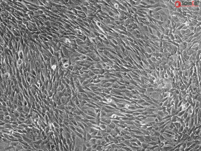 Human Skeletal Muscle Cells, HSkMC