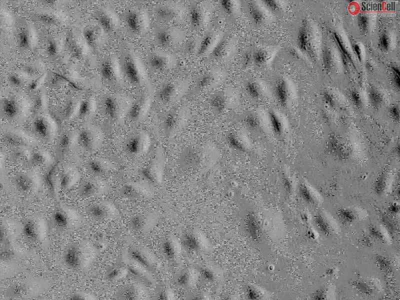 Human Renal Glomerular Endothelial Cells, HRGEC