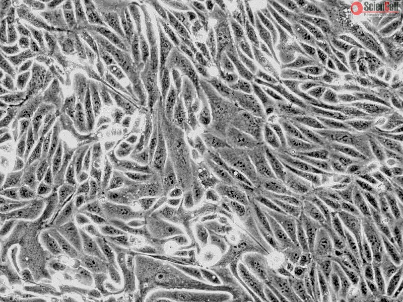 Human Renal Cortical Epithelial Cells, HRCEpiC