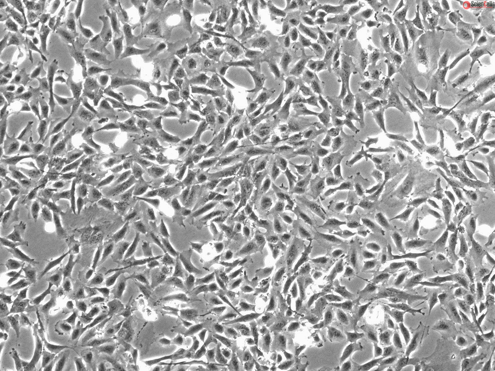 Human Renal Mesangial Cells, HRMC