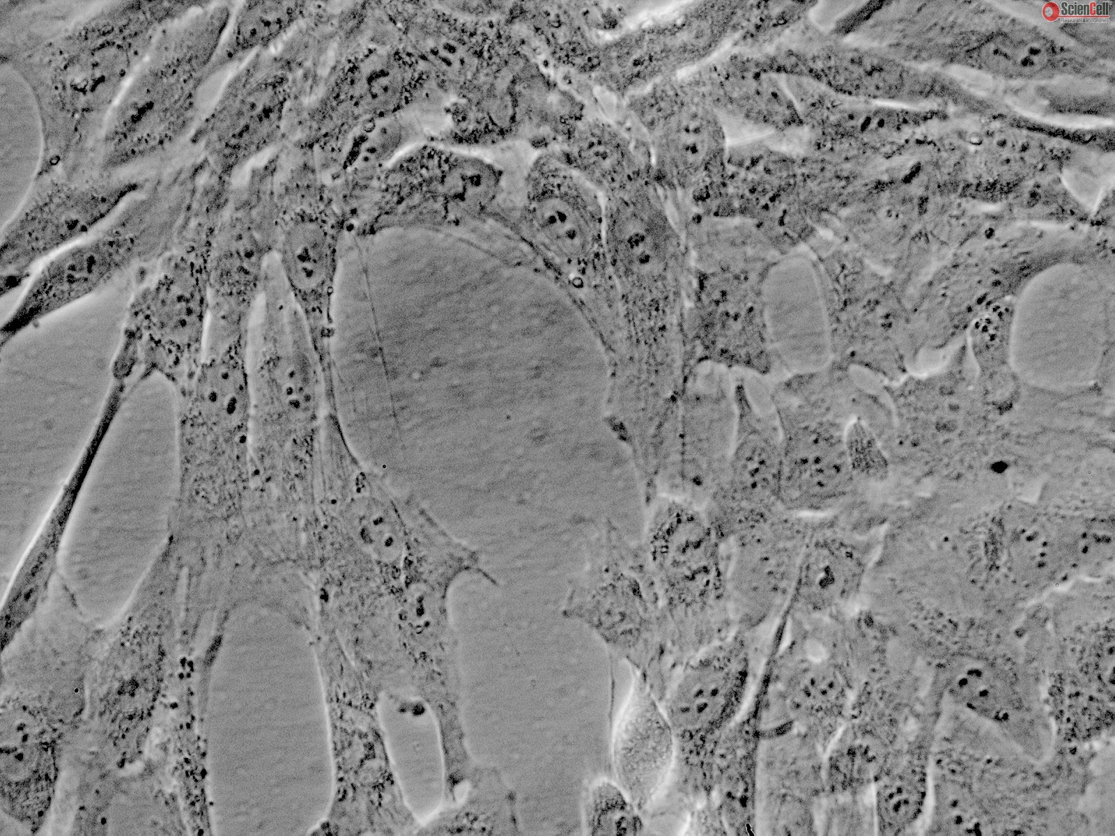Human Renal Mesangial Cells, HRMC