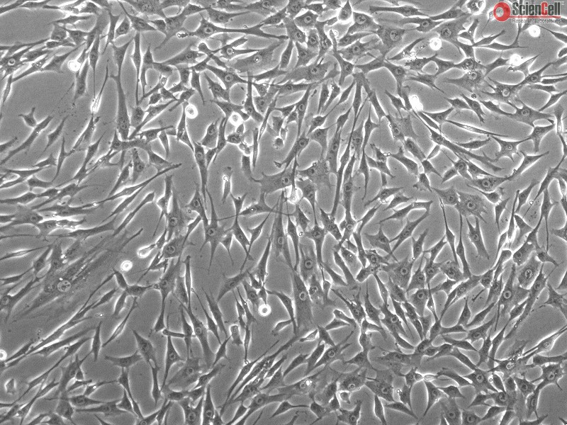 Human Bladder Smooth Muscle Cells, HBdSMC