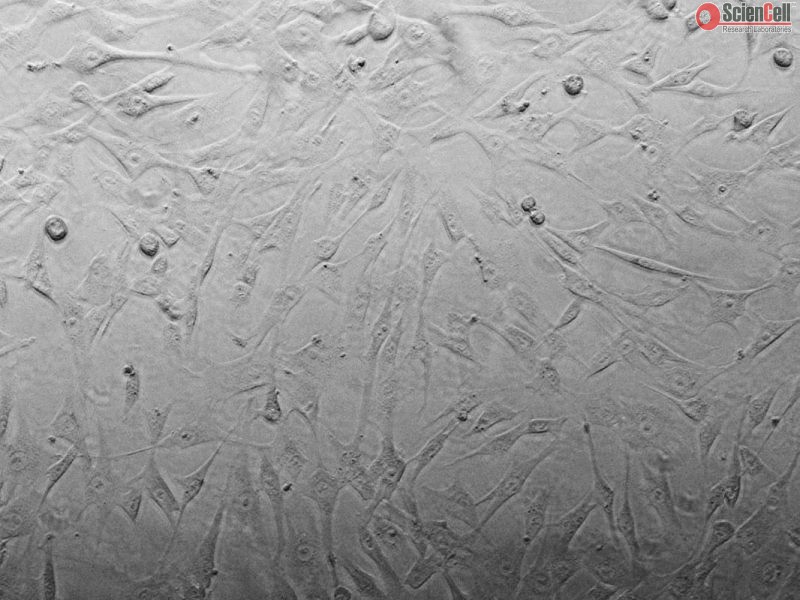 Human Bladder Smooth Muscle Cells, HBdSMC