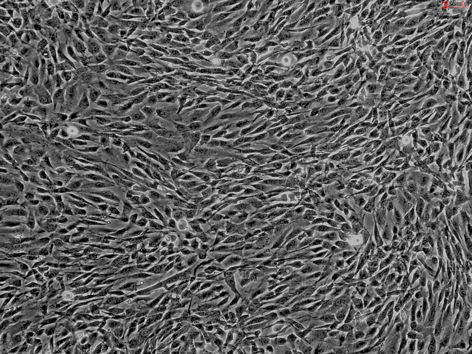 Human Sertoli Cells (HSerC)