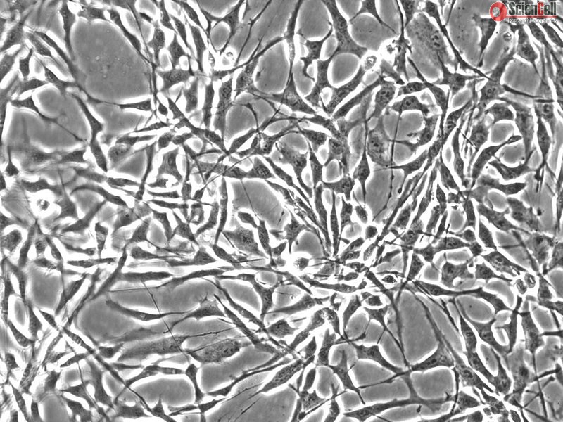 Human Synoviocytes, HS