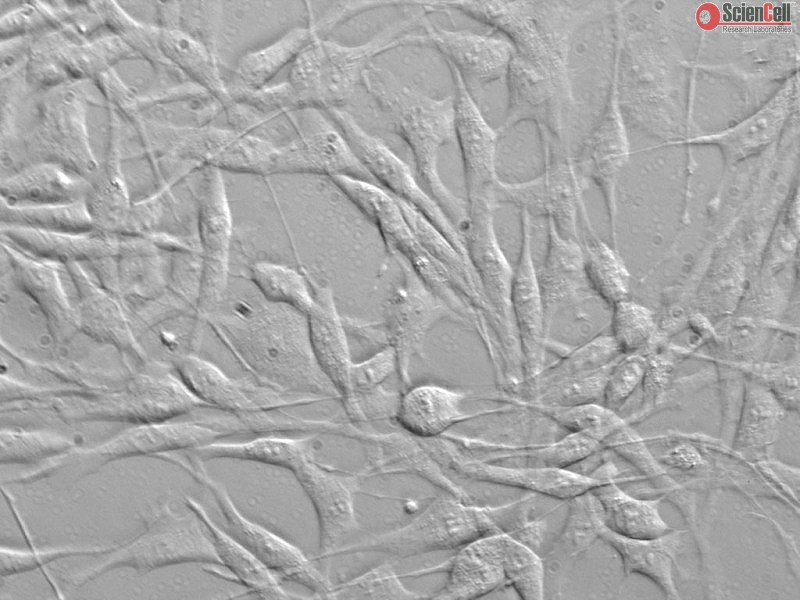 Human Synoviocytes, HS