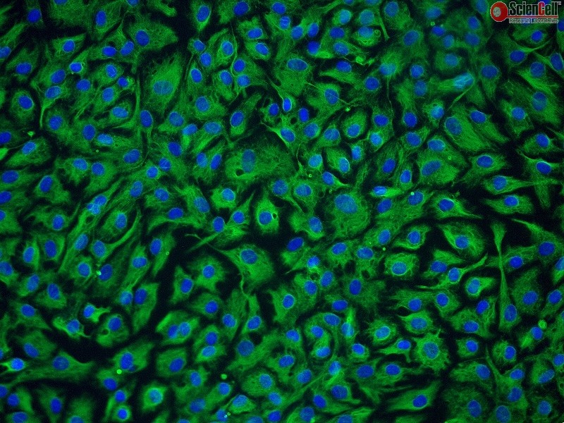 Human Nucleus Pulposus Cells