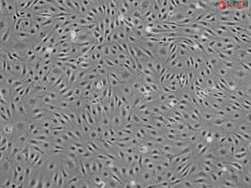 Human Hepatic Sinusoidal Endothelial Cells, HHSEC