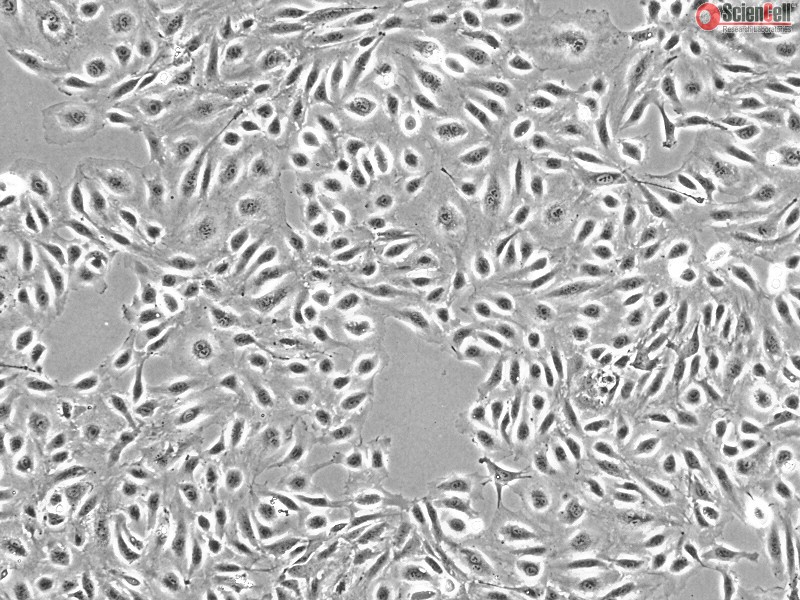 Human Cardiac Microvascular Endothelial Cells, HCMEC