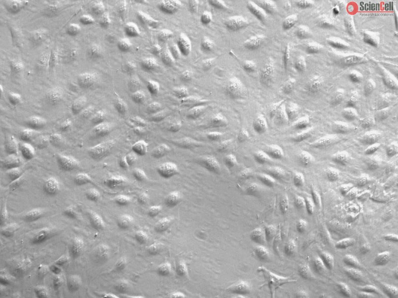 Human Cardiac Microvascular Endothelial Cells, HCMEC